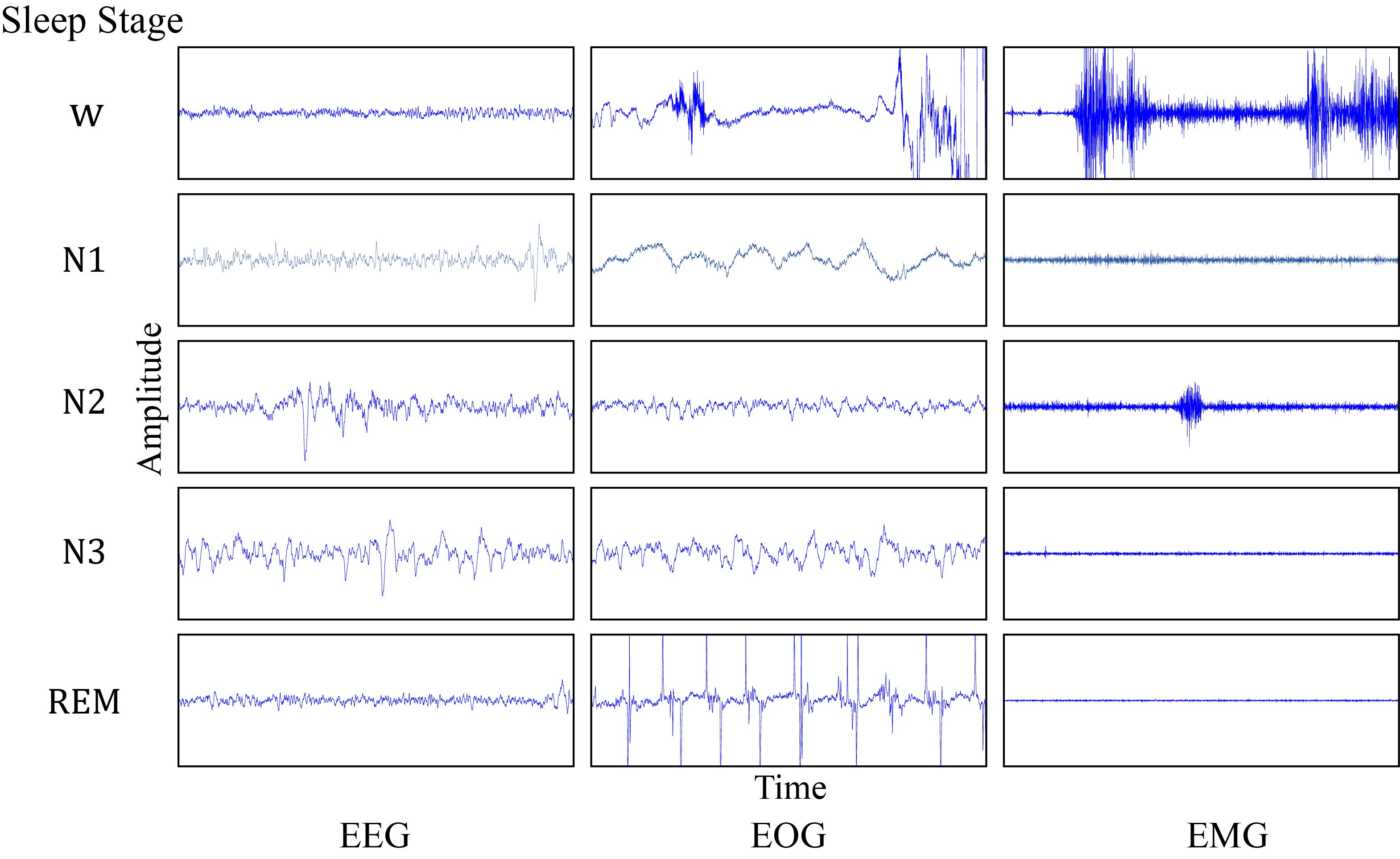 Researches on Sleep Staging based on Multivariate Multimodal Signals ... Researches on Sleep Staging based on Multivariate Multimodal Signals ...